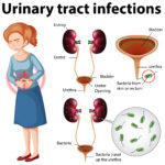 Pus Cells In Urine: What They Mean And Why You Shouldn't Ignore Them ...